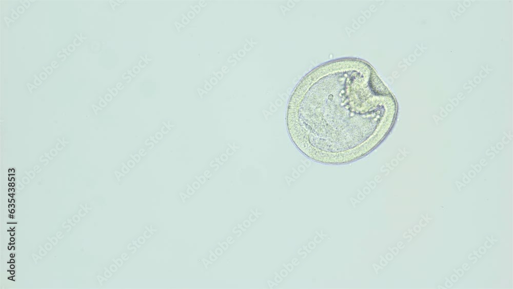 Larvae sea urchin Strongylocentrotus pallidus under microscope, phylum ...