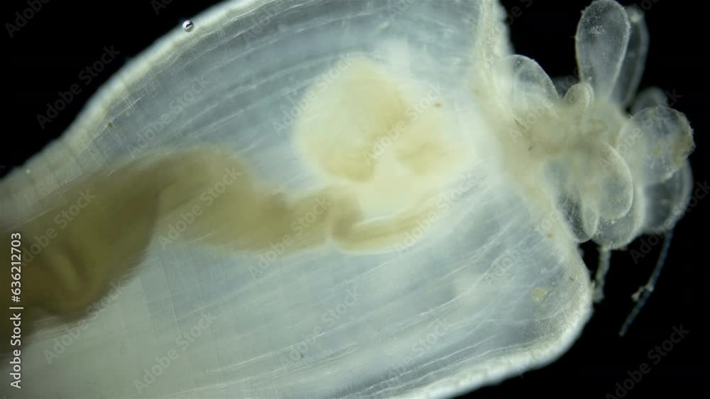 Cactus worm Priapulus caudatus under microscope, phylum Priapulida ...