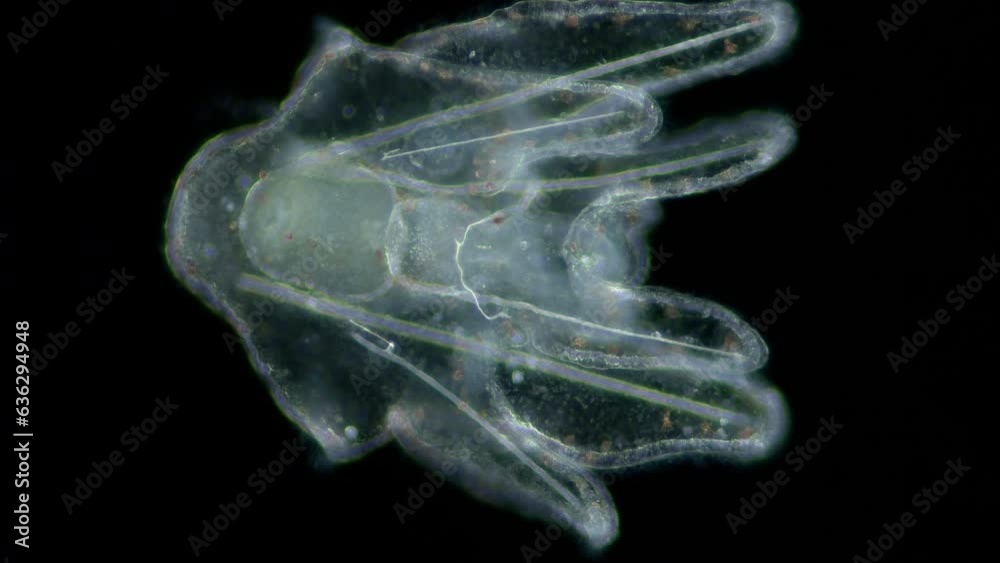 Larvae sea urchin Strongylocentrotus pallidus under microscope, phylum ...