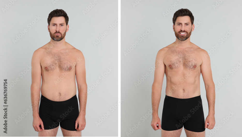Collage with portraits of man before and after weight loss on light ...