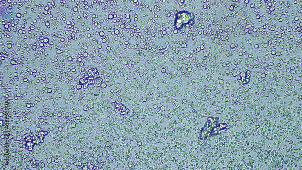 Breast milk under the microscope, woman lactating milk Feeding a baby ...