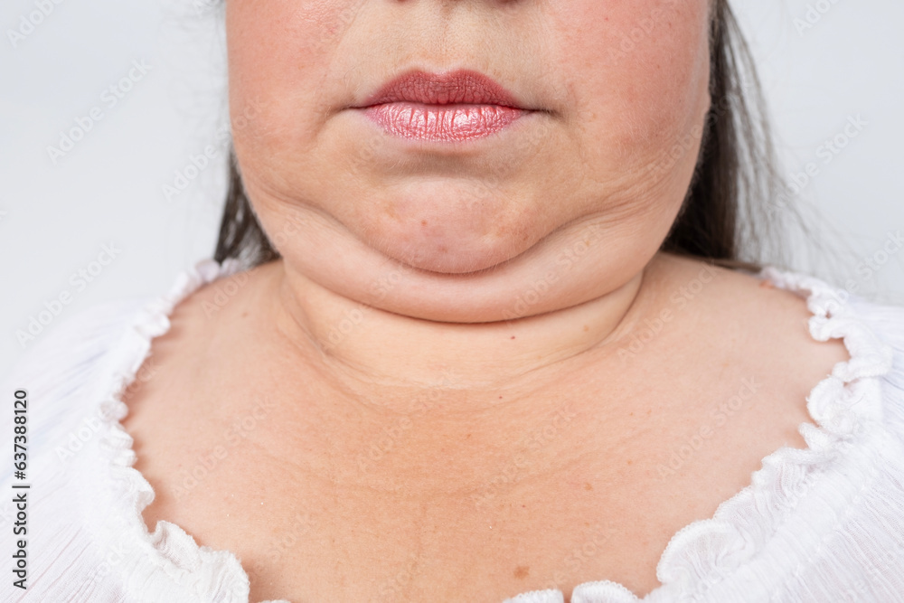 Double chin face mature woman 50 years old, human fat neck, wrinkles on ...