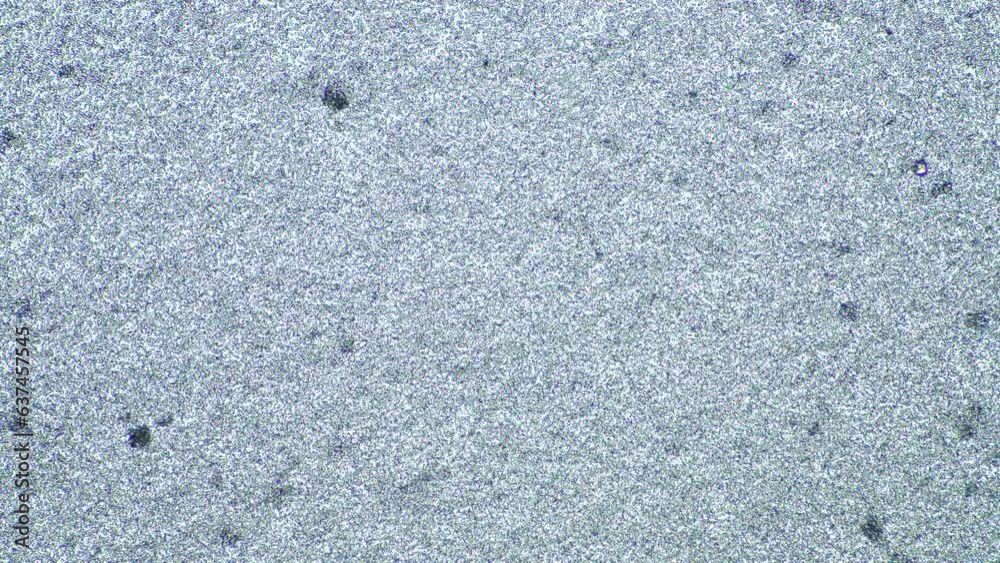 Breast milk under the microscope, woman lactating milk Feeding a baby ...