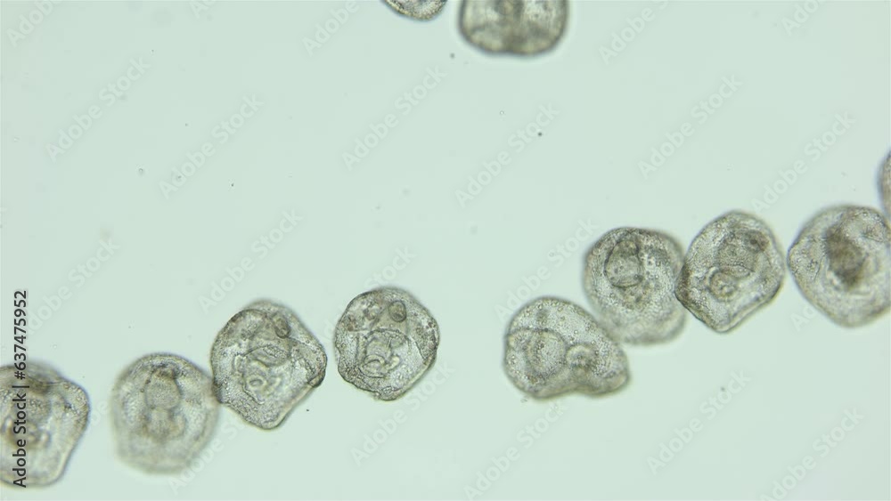 Larvae sea urchin Strongylocentrotus pallidus under microscope, phylum ...