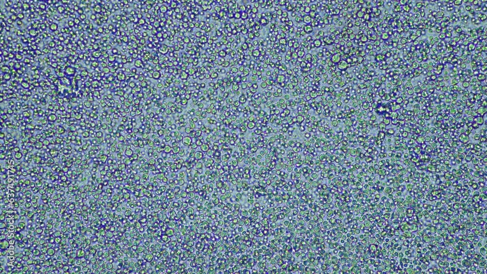 Breast milk under the microscope, woman lactating milk Feeding a baby ...