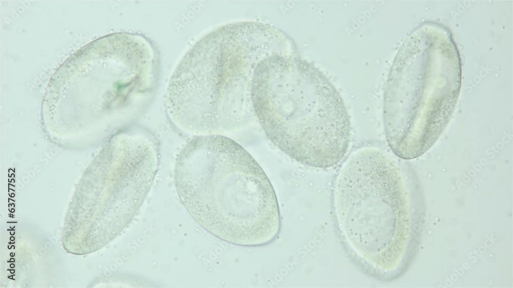 Sperm and ovule of worm Polychaeta Ophelia limacina under microscope ...
