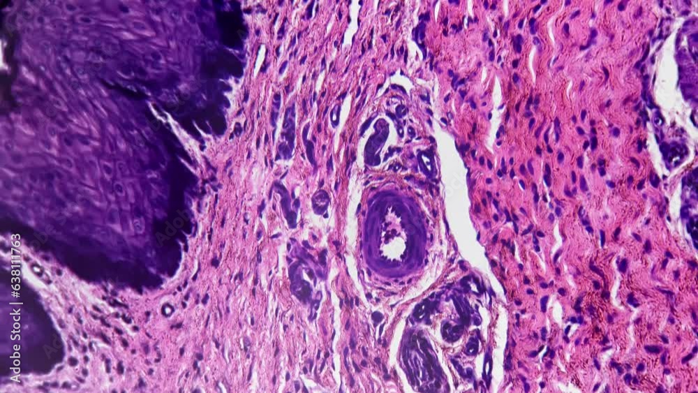 A microscopic view of a cross sectional view of the human penis under ...