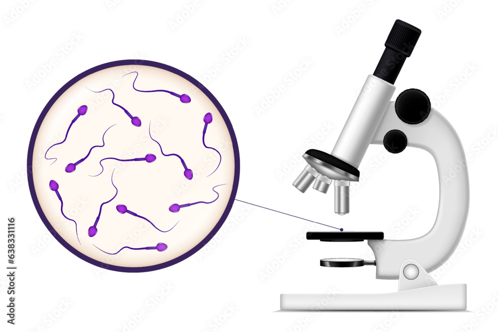 Enlarged view of the sperms under a microscope. sperms for semen ...