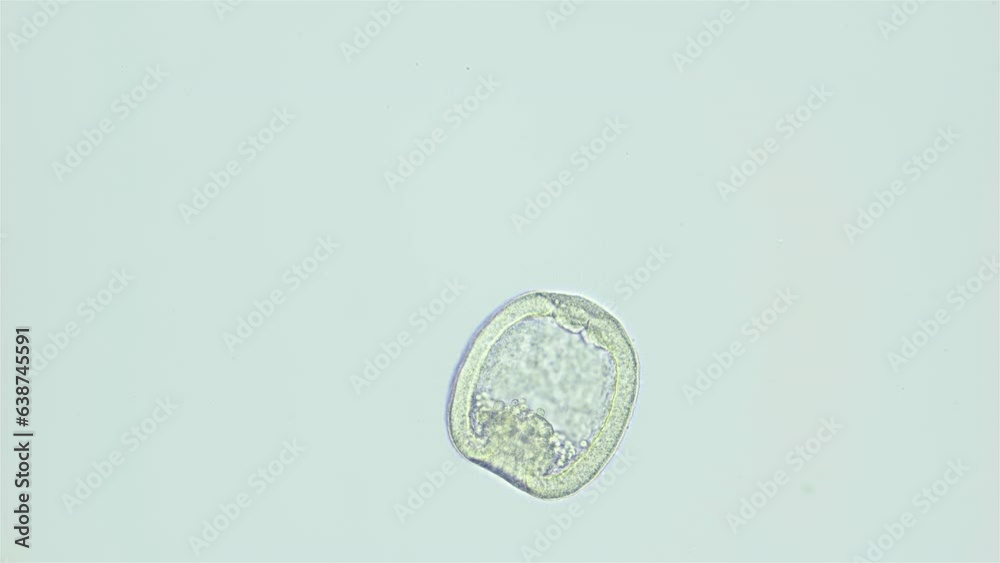 Larva sea urchin Strongylocentrotus pallidus under microscope, phylum ...