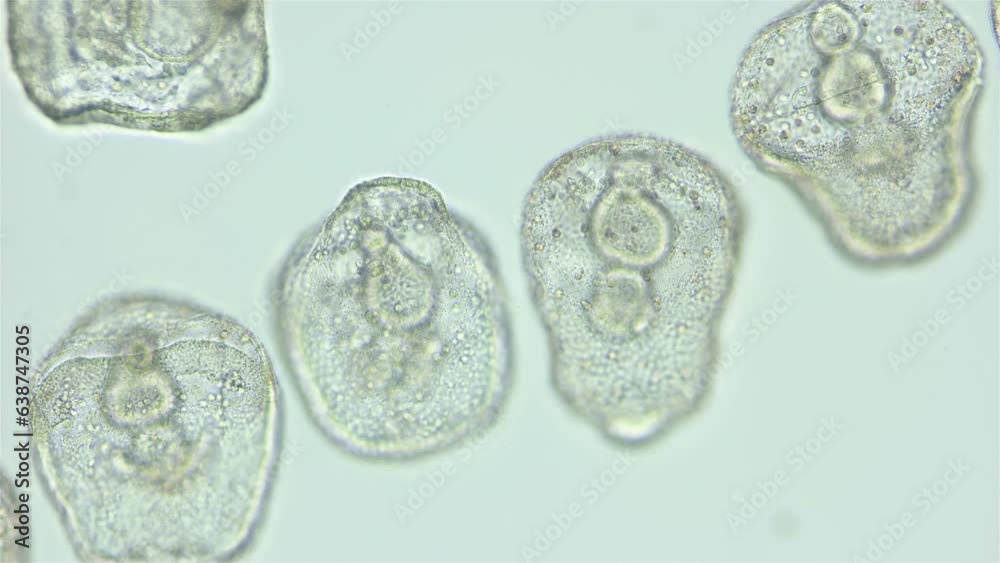 Larvae sea urchin Strongylocentrotus pallidus under microscope, phylum ...
