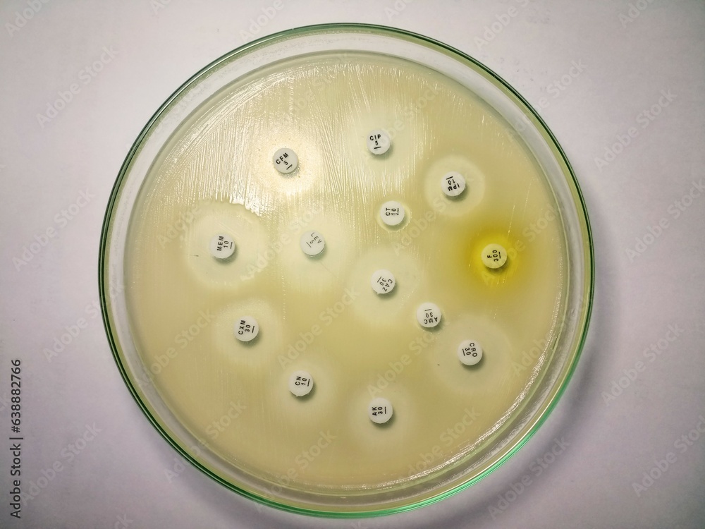 Sensitivity test of E. Coli in mueller Hinton agar. Stock Photo | Adobe ...