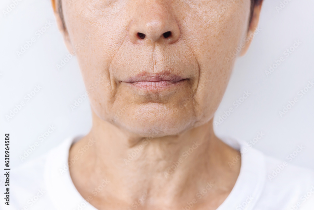 Elderly caucasian woman's face and neck with signs of skin aging ...
