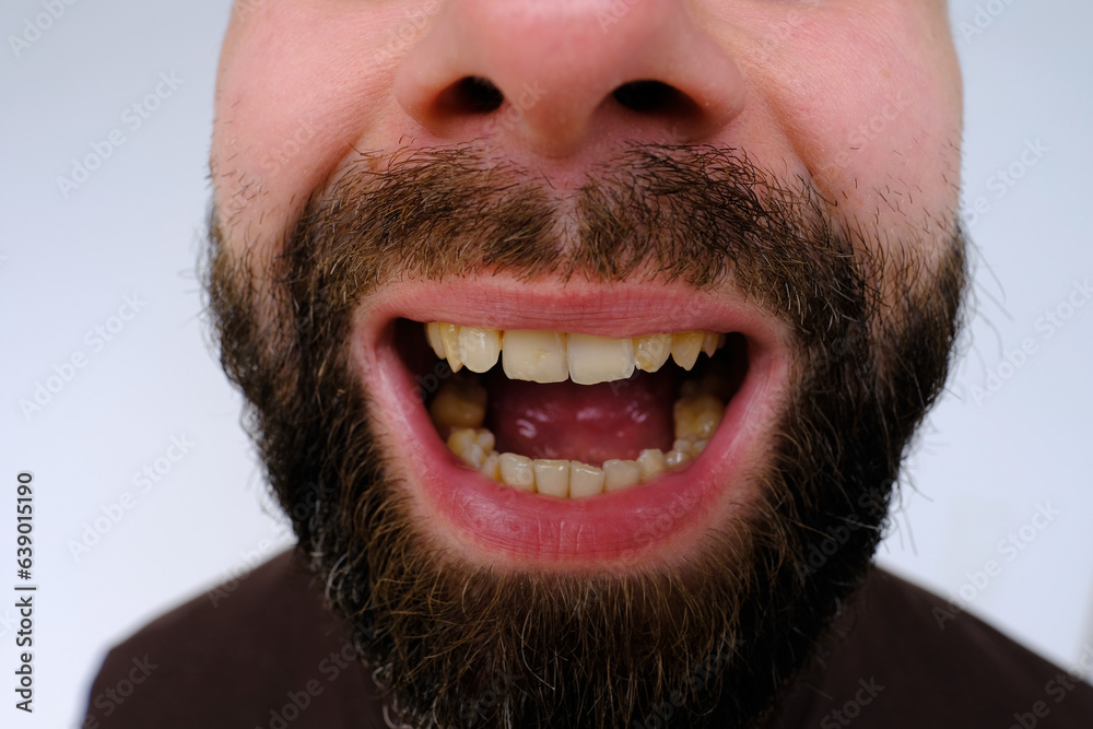 ridiculously funny joke, male joker laughs with his mouth wide open ...