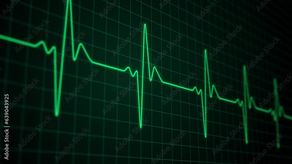 Patient monitor displays vital signs ECG electrocardiogram EKG, oxygen ...