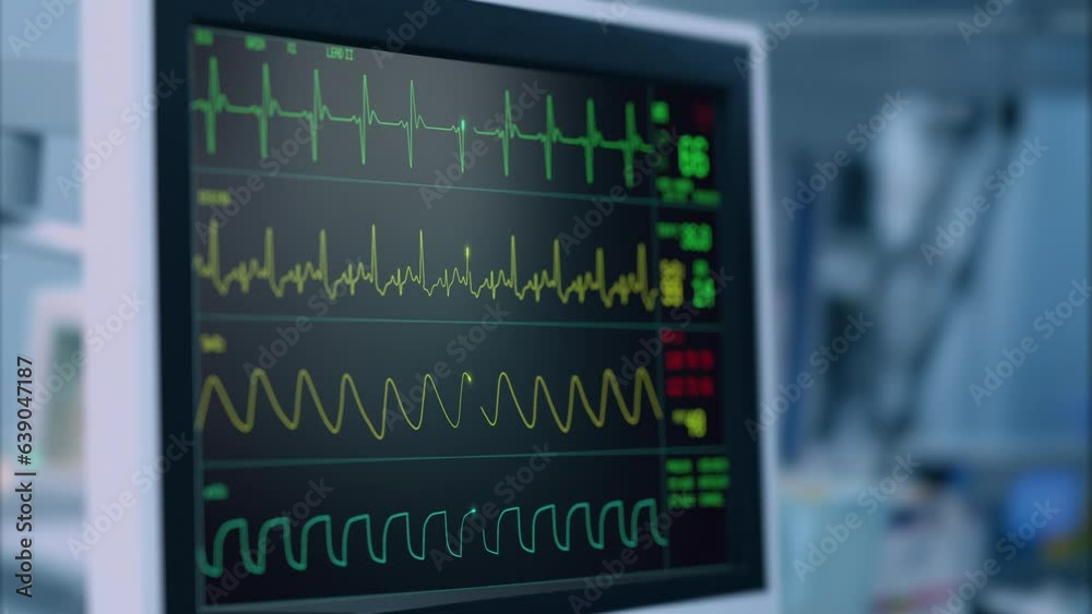 Patient monitor displays vital signs ECG electrocardiogram EKG, oxygen ...