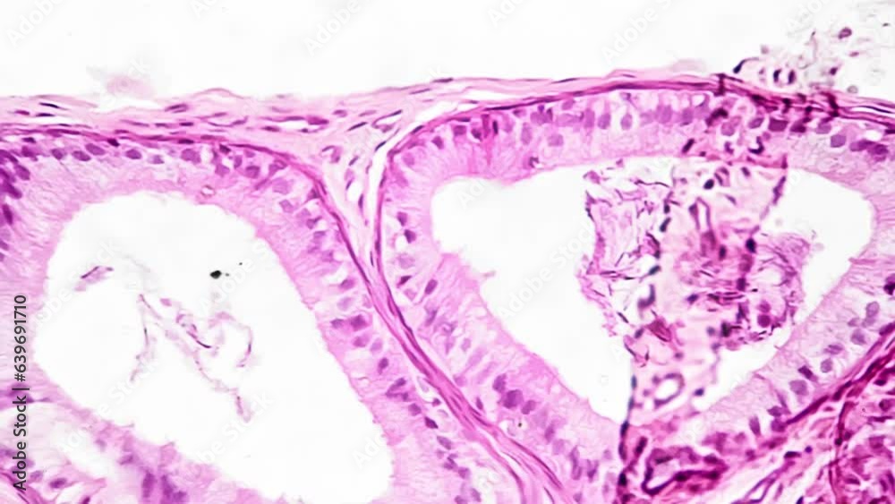 Testis in section of human being at scientific slide magnified under ...