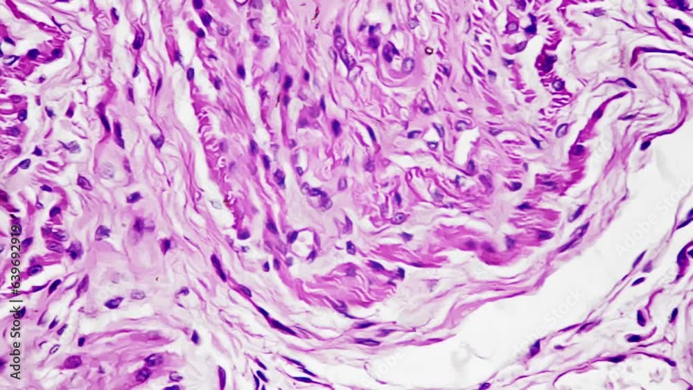 Microscopic magnification of a specific section of the human vagina ...