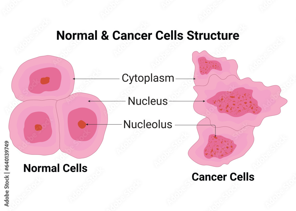 Normal Cell and Cancer Cell Structure Vector Illustration Stock Vector ...