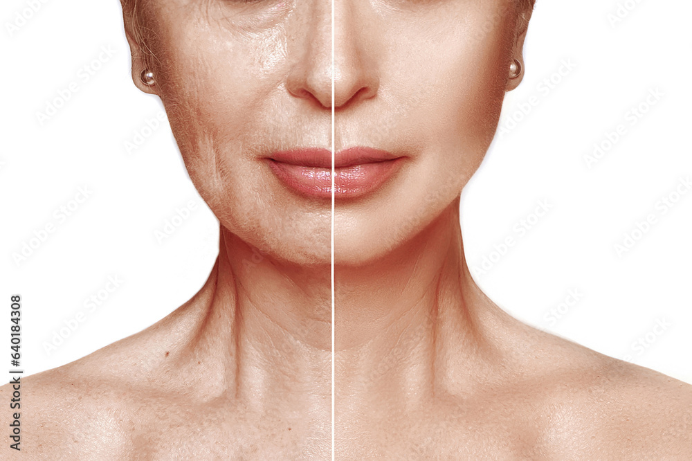 The lower part of the face and décolleté zone of a woman after 50 years ...