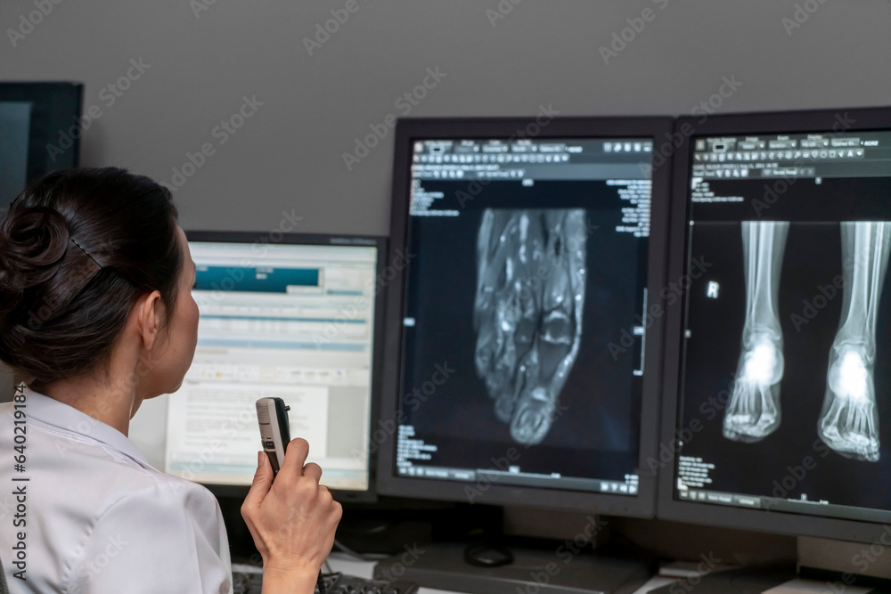 radiology doctor examines foot, ankle x-ray, mr image and reports with ...