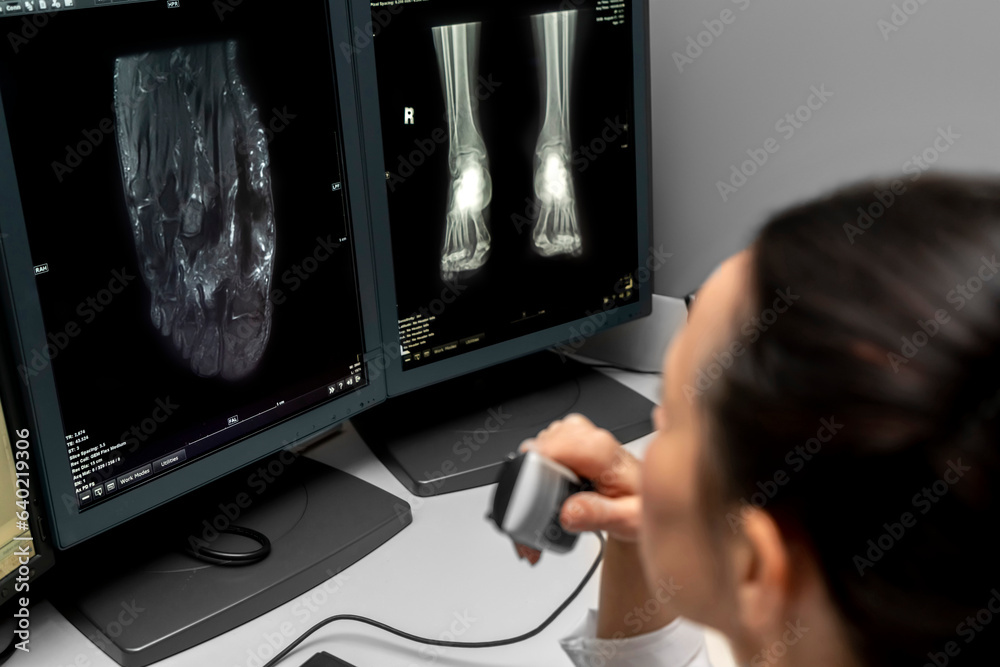 radiology doctor examines foot, ankle x-ray, mr image and reports with ... radiology doctor examines foot, ankle x-ray, mr image and reports with ...