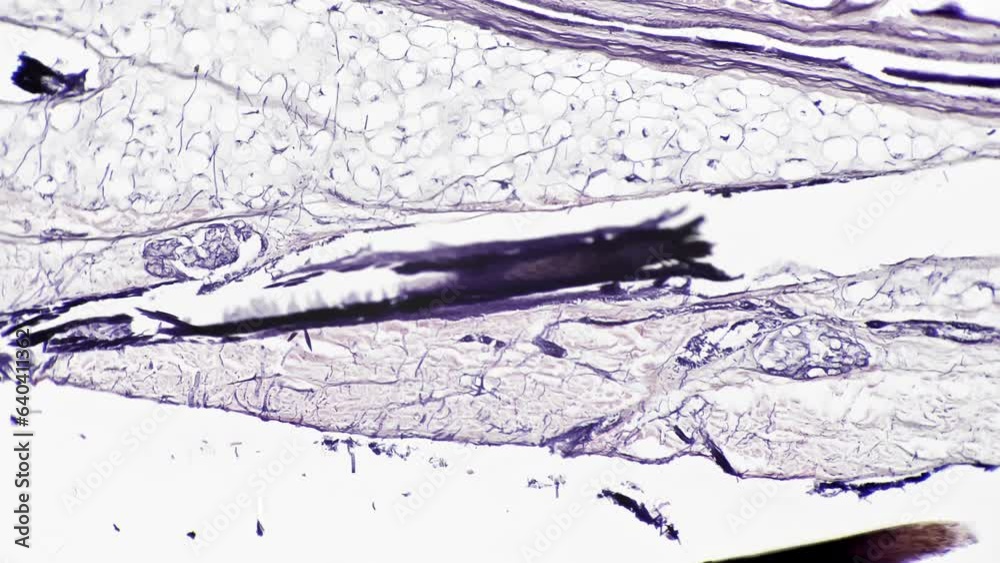 Skin section through hair follicle filmed under microscope 100x on ...