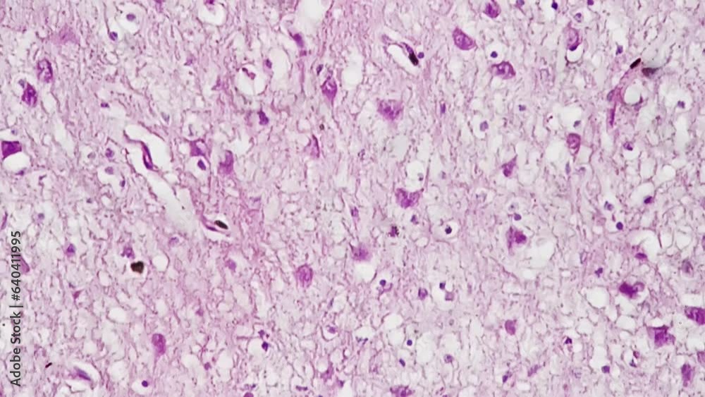 Sensory cortex in section of human magnified in 400 times under ...