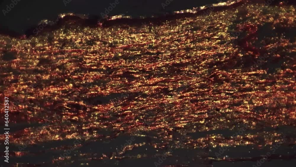 Human skin in section showing thick cornified layer filmed under ...