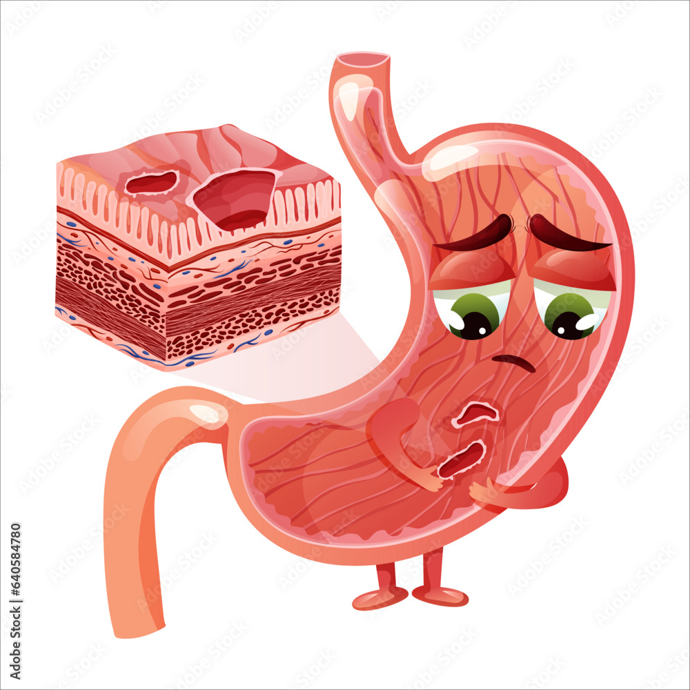 Stomach ulcers. Cute and sad stomach character with face and two ulcers ...