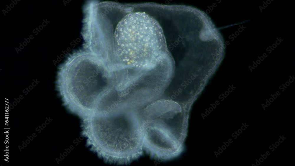 Pilidium larva of worm Heteronemertea under microscope, genus ...