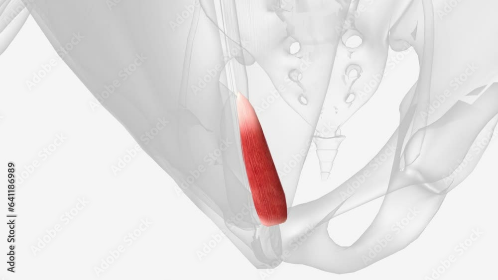 Pyramidalis is classified as a vestigial muscle which is frequently ...