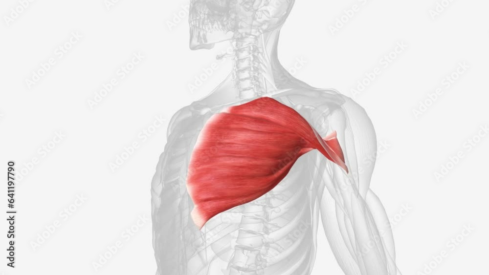 A pectoralis major strain refers to a tear in the large muscle which ...