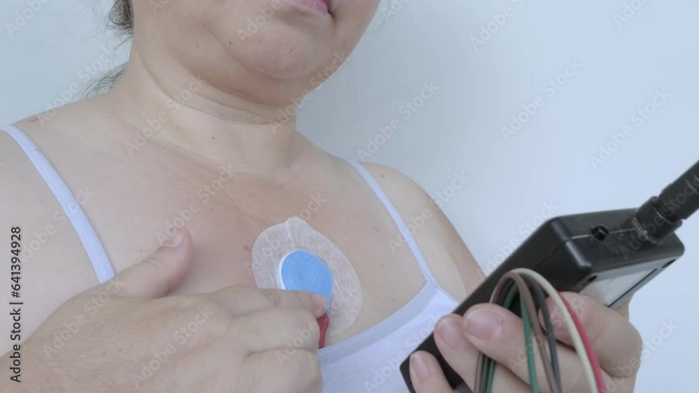 sensors on female body for Holter monitoring, woman with Holter monitor ... sensors on female body for Holter monitoring, woman with Holter monitor ...