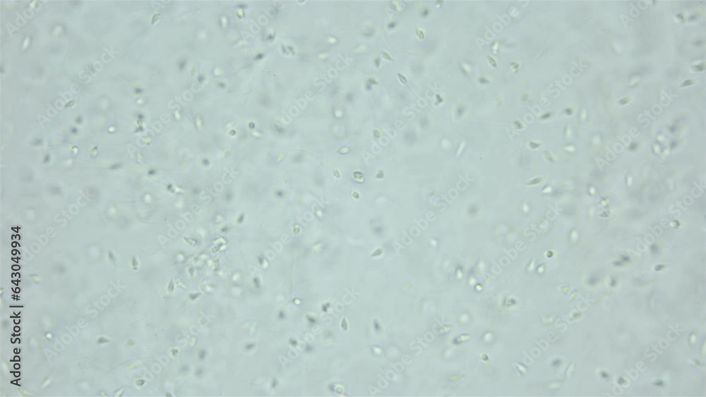 Sperm sea urchin Strongylocentrotus pallidus under microscope, phylum ...