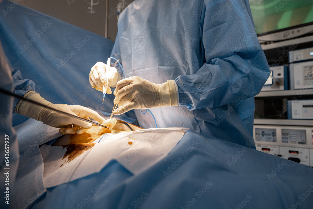 Foto de Two surgeons operates abdominal area of a patient. Concept of ...