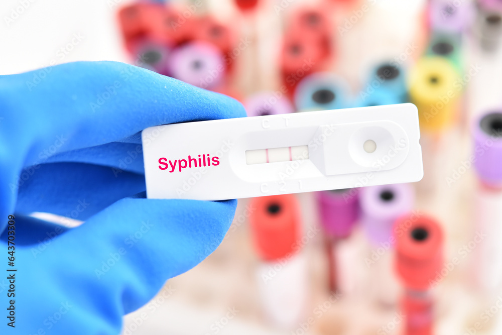 Syphilis positive test result by using rapid test device Stock Photo ...