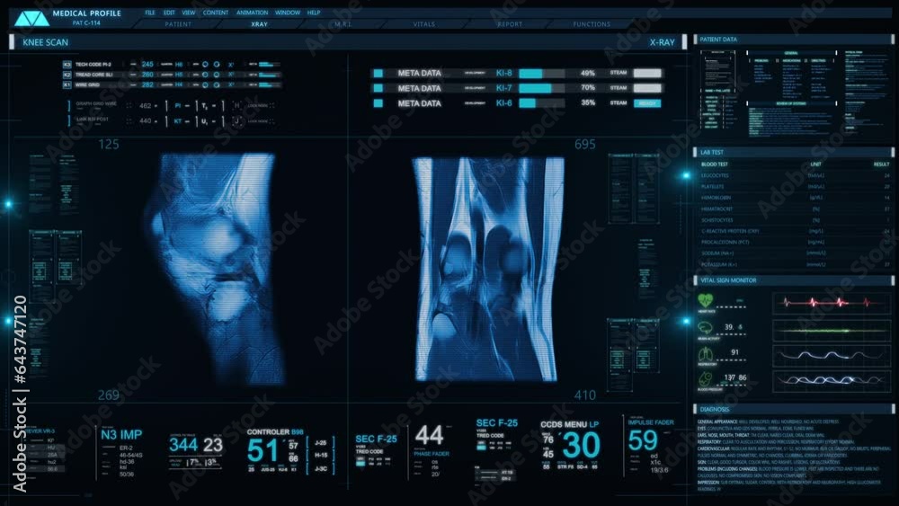 Futuristic Technological Interface Analyzing Human Anatomy. MRI Knee ...