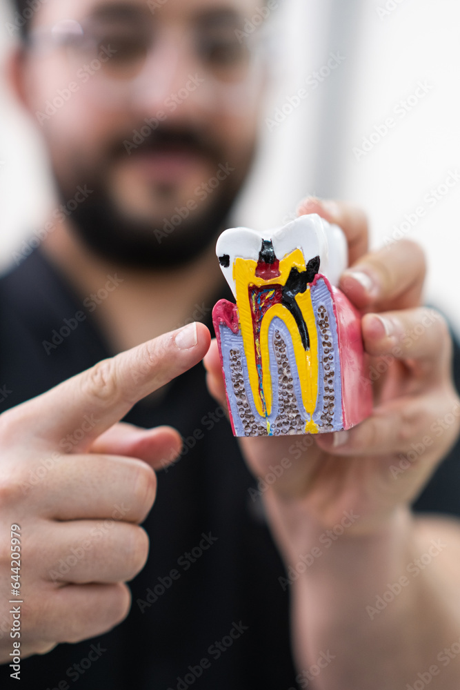 Dentist pointing to plastic model of human tooth with multiple caries ...