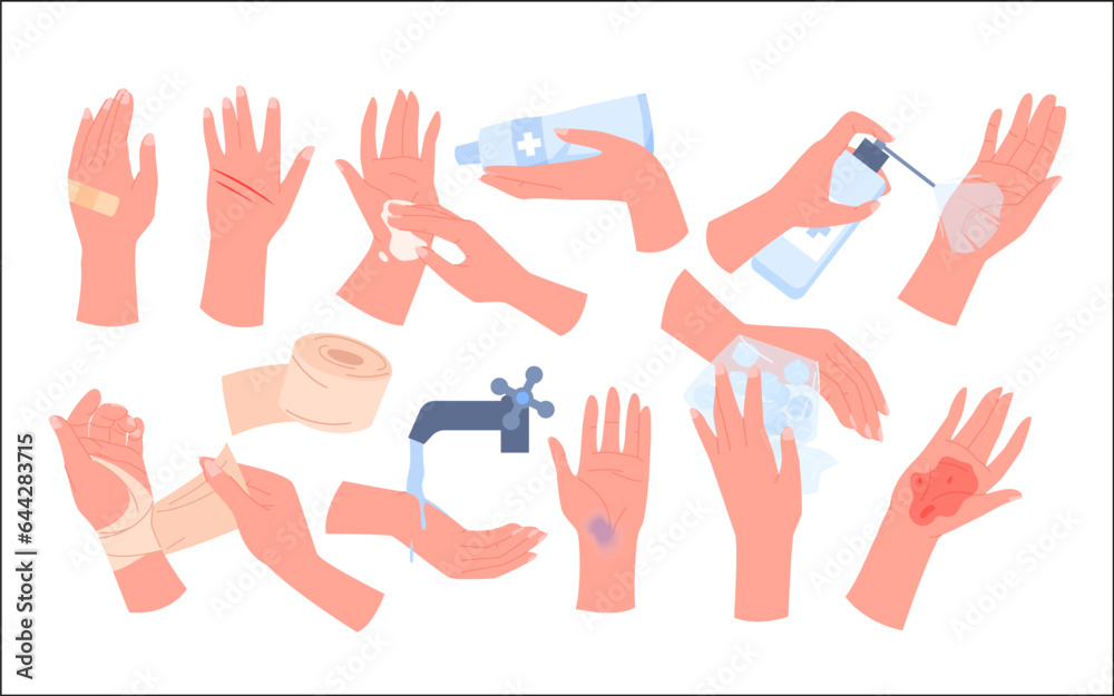 Vecteur Stock Cartoon isolated broken arms with wound, bruise or ...