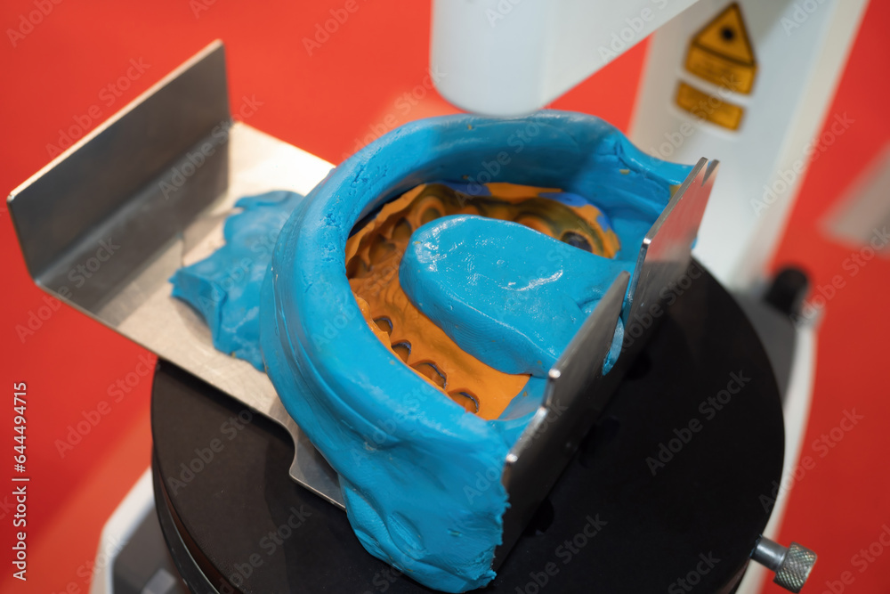 Dental cast of teeth. Form for manufacture of dentures. Orthodontic ...