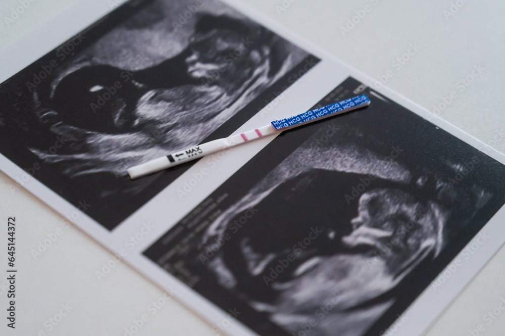Positive pregnancy test in a photo from an ultrasound on a white table ...
