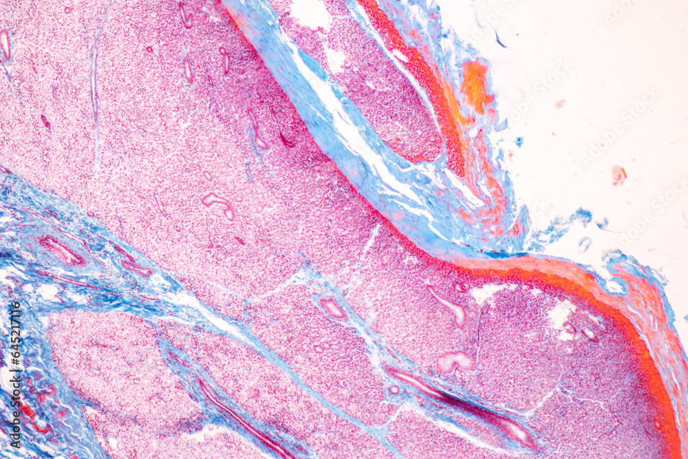 Fotografia do Stock: Anatomy and Histological Tonsil and Parotid Human ...