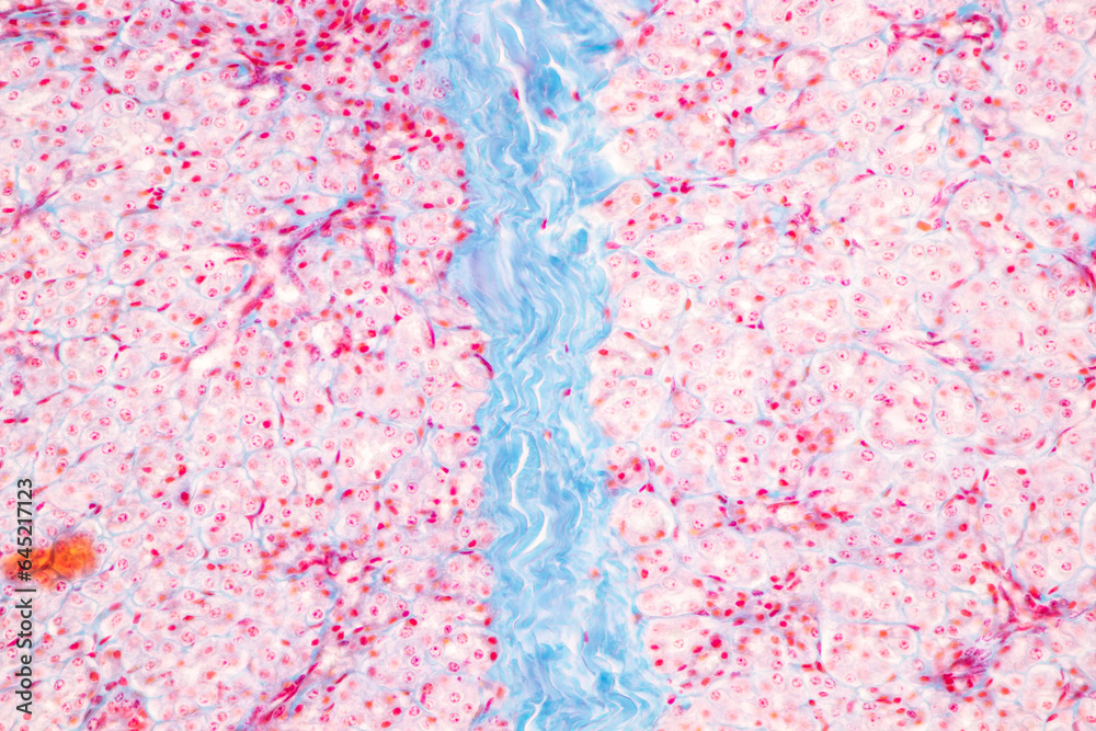 Anatomy and Histological Tonsil and Parotid Human cells under ...