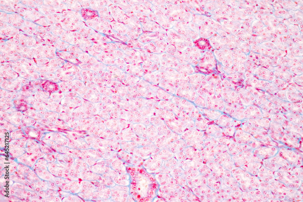 Anatomy and Histological Tonsil and Parotid Human cells under ...