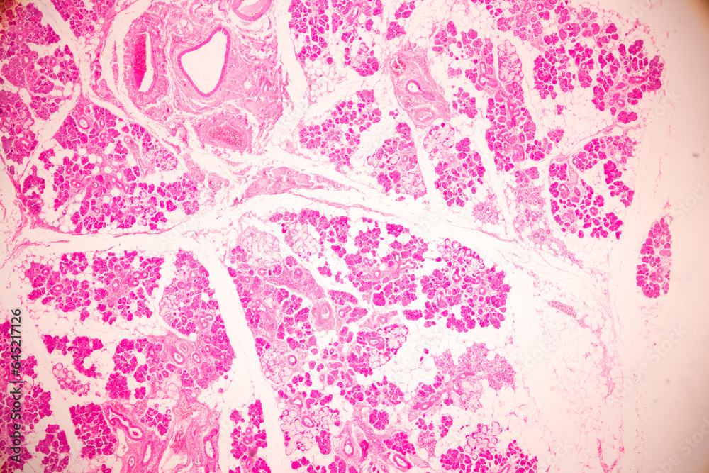 Anatomy and Histological Tonsil and Parotid Human cells under ...