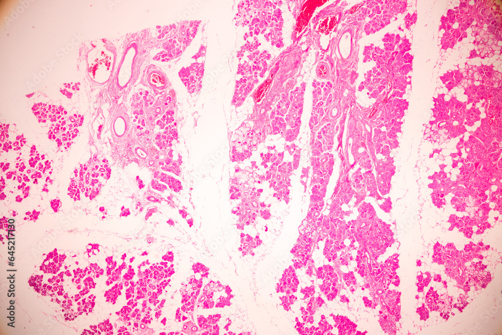 Anatomy and Histological Tonsil and Parotid Human cells under ...