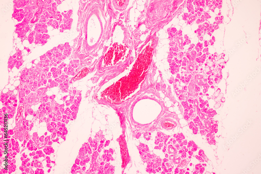 Fotografia do Stock: Anatomy and Histological Tonsil and Parotid Human ...
