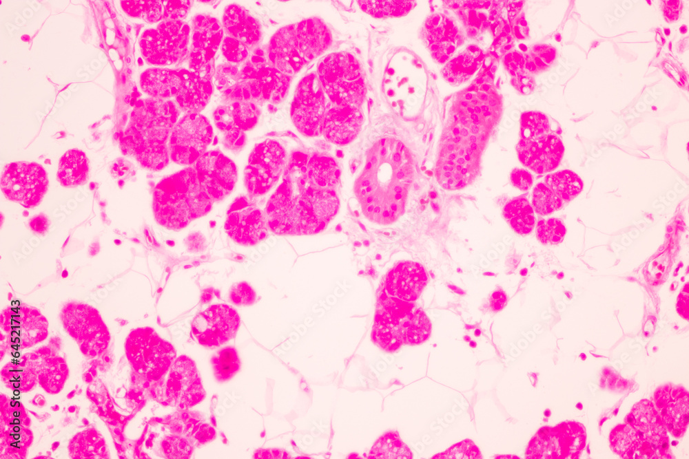 Anatomy and Histological Tonsil and Parotid Human cells under ...