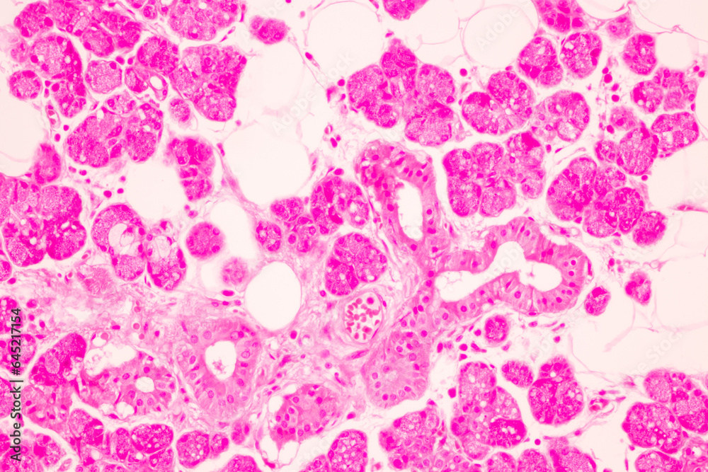 Anatomy and Histological Tonsil and Parotid Human cells under ...