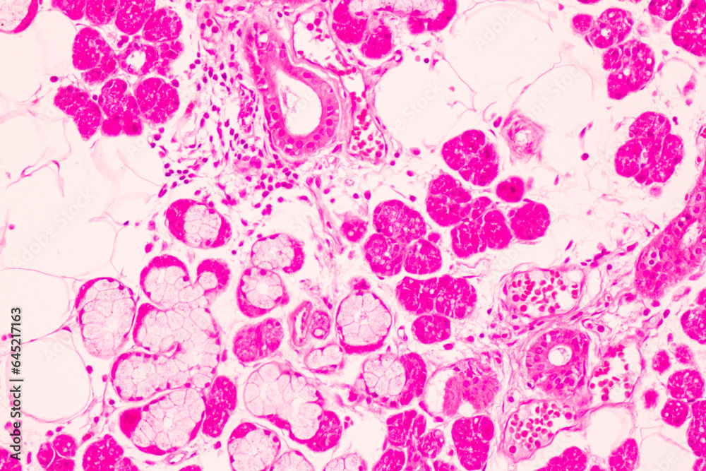 Anatomy and Histological Tonsil and Parotid Human cells under ...